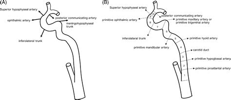 Stapedial Artery And Hyoid Artery