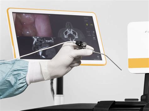 Sd News Wire On Linkedin Electromagnetic Navigation Bronchoscopy Enb