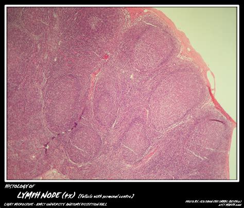 Histology Lymph Node My Aimst University Lifestyle Blog