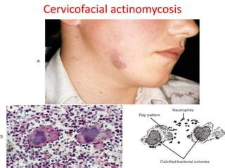 Actinomycetes Pptx
