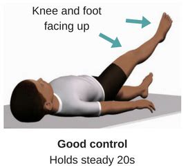 Pigeon Toes Causes And How Exercises Can Help To Improve Intoeing Gait