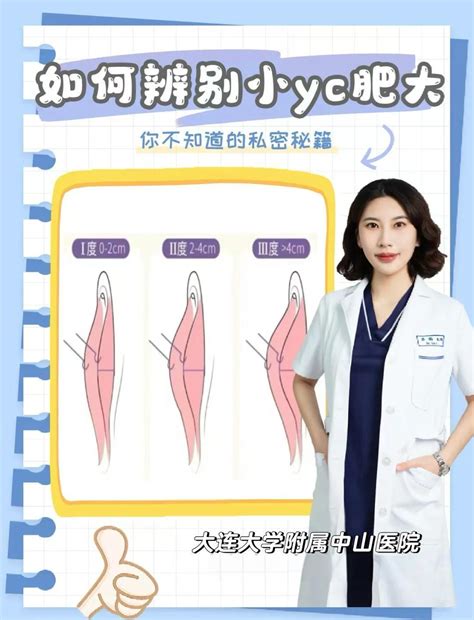 如何判断小阴唇是否肥大？