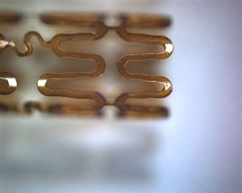 Motion Control Galvanometer Assisted Stent Processing Increases Next Generation Device