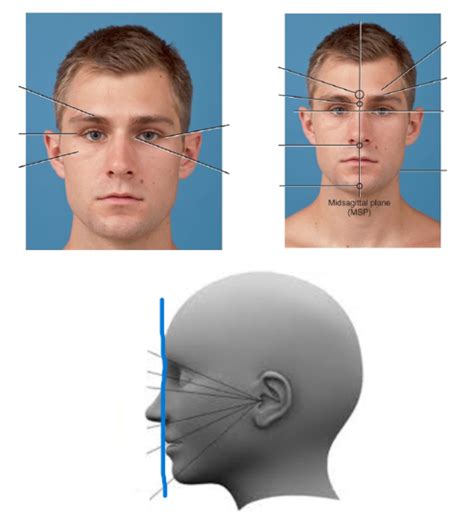 Skull Landmarks And Positioning Lines Diagram Quizlet
