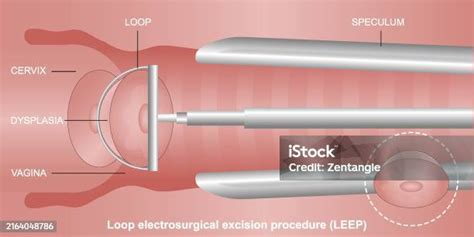 A Leep Stock Illustration Download Image Now Adult Anatomy