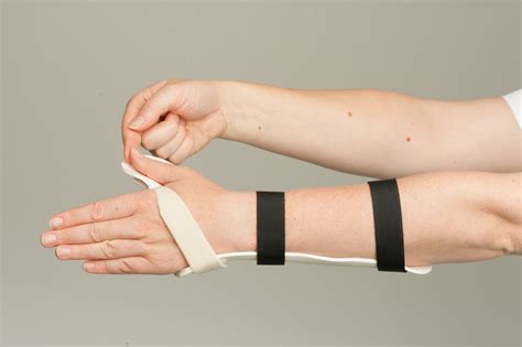 Extensor Tendon Repair Thumb A Guide To Your Therapy Leeds Teaching Hospitals Nhs Trust