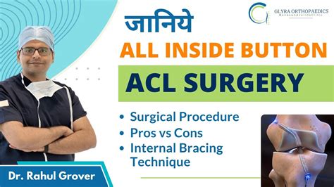 All Inside Button Acl Reconstruction A Comprehensive Guide To The