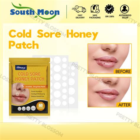 South Moon Mouth Blister Patch Relieves Shrinkage Around Lips Granular