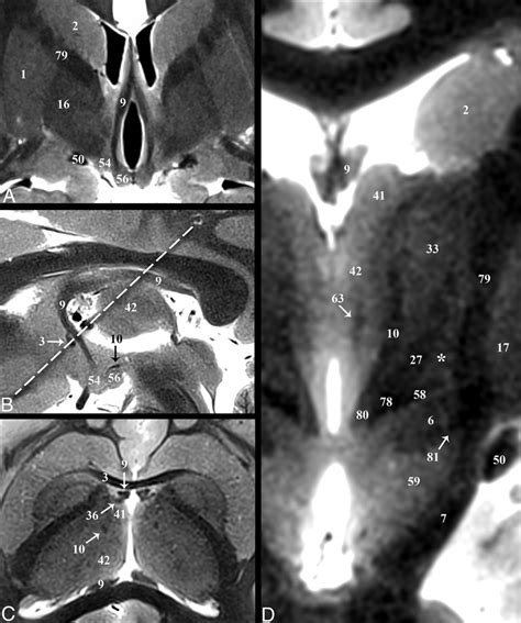 Selected Images Illustrating The Subthalamic Nucleus In The Basal Download Scientific