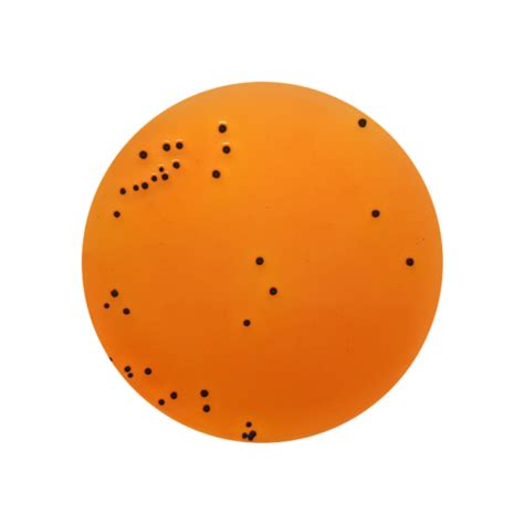 Desoxycholate Citrate Agar 90mm Plate Southern Group Laboratory