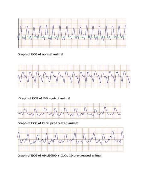 Graph Of Ecg Pdf