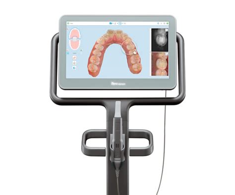 Purchasing Solutions Of Intraoral Scanners Itero