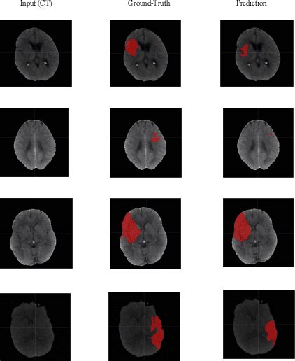 Ischemic Stroke Lesion Segmentation Using Adversarial Learning