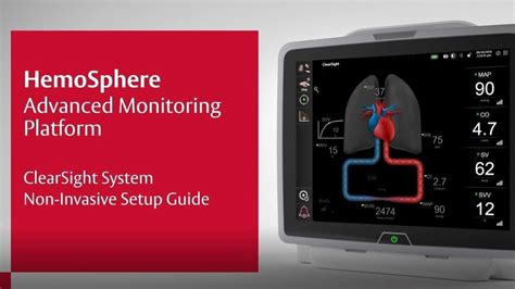 Noninvasive Clearsight System Setup On The Hemosphere Monitor Youtube