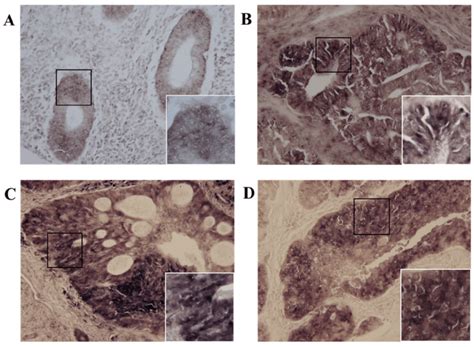 Light Micrography Of Human Proliferative Endometrium A Shows Moderate Download Scientific