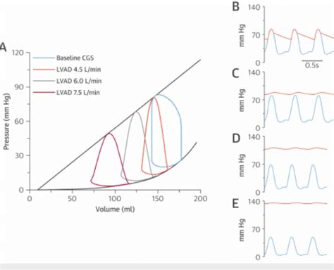 Shows Flow Dependent Changes Of The Pressurevolume Loop With Download Scientific Diagram