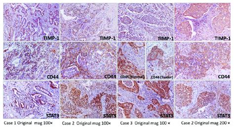 Formalin Fixed Paraffin Embedded Surgical Pathology Specimens From Download Scientific Diagram