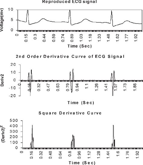 Qrs Complex Or R R Interval Detection Download Scientific Diagram