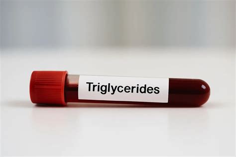 The Quick Guide To Triglycerides And Why They Matter Levels Levels