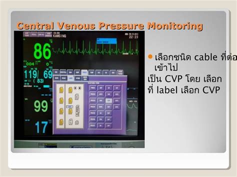 Cvp Central Venous Pressure Monitoring Ppt