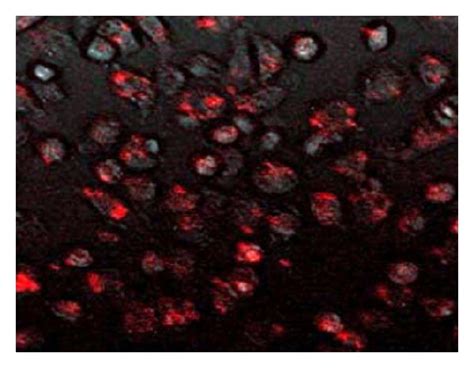 The Role Of Epinephrine In Macrophage Phagocytosis Under Lps