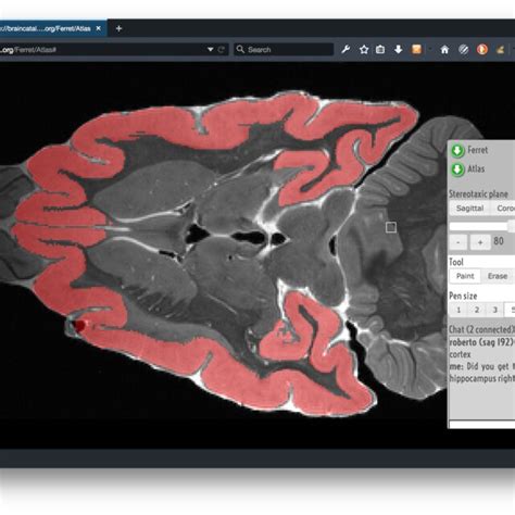 Collaborative Online Brain Segmentation Example From Brain Catalogue