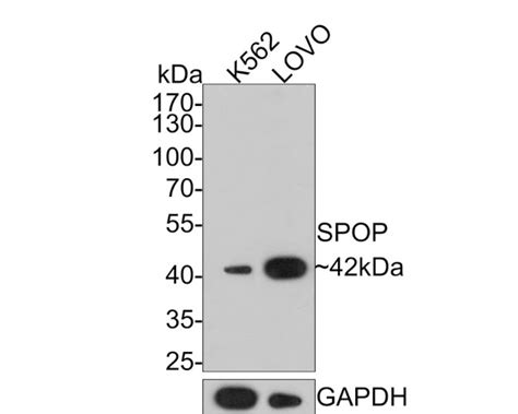 Spop Recombinant Monoclonal Antibody Je36 04 Ma5 50809