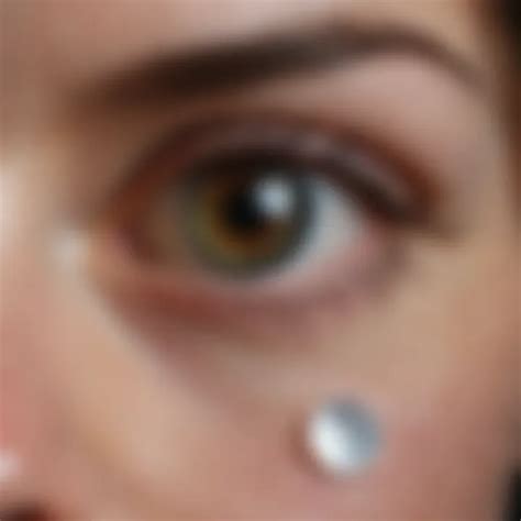 Understanding Chlamydia In The Eye Symptoms And Implications