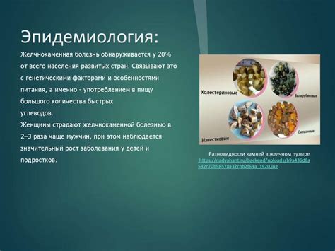 Камни в желчном пузыре Современная диагностика и способы лечения презентация онлайн