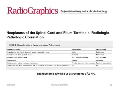 Neoplastic Disorders Of Spinal Cord Pptx