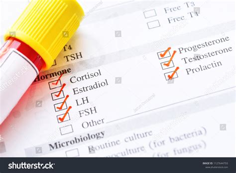 Blood Sample Tube Laboratory Requisition Form ภาพสต็อก แก้ไขตอนนี้