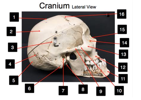 Anatomy Cranium Lateral Diagram Quizlet