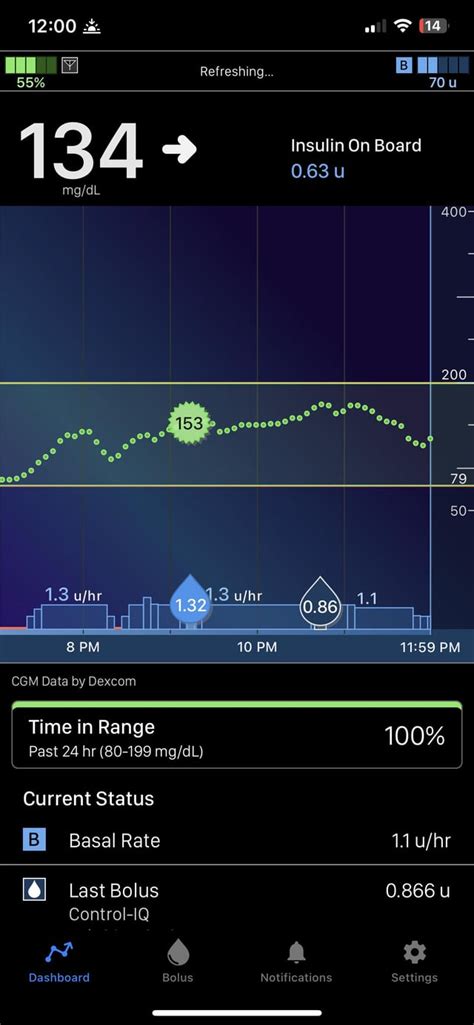 Dexcom Readings Wayyyy Out Rdiabetes