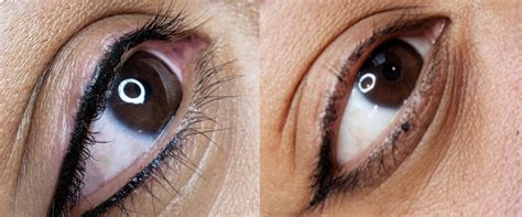 Permanent Eyeliner Gone Wrong