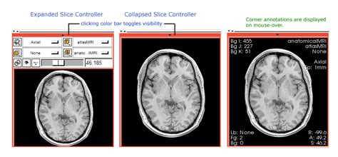 Modulesmainapplicationgui Documentation 36 Slicer Wiki