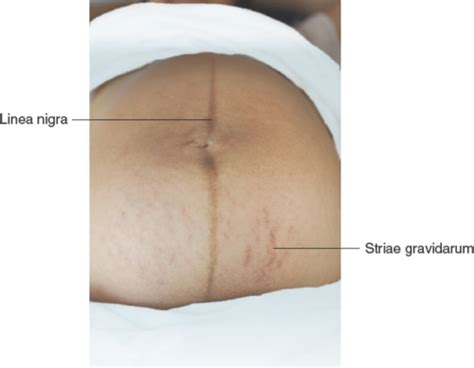 Patient Assessment Prenatal Exam Flashcards Quizlet
