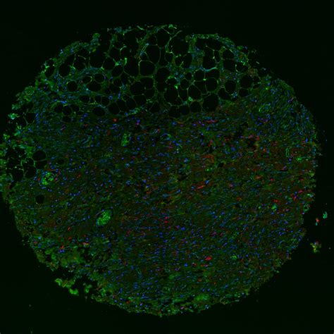 Colocalization Analysis Image Analysis Imagesc Forum