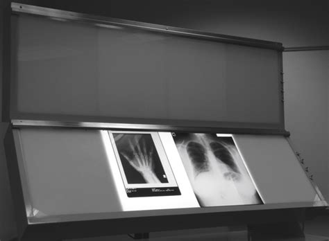 image processing and display radiology key