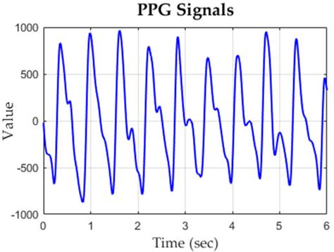 A Typical Experimental Ppg Waveform Measured By The Proposed Ppg Sensor Download Scientific