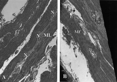 Electron Microscopy Of The Myoblast Injected Porcine Myocardium Showing