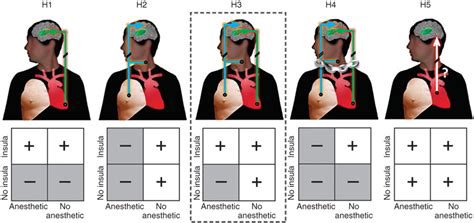 Schematic Representing Possible Pathways Of Interoceptive Awareness Two Download Scientific