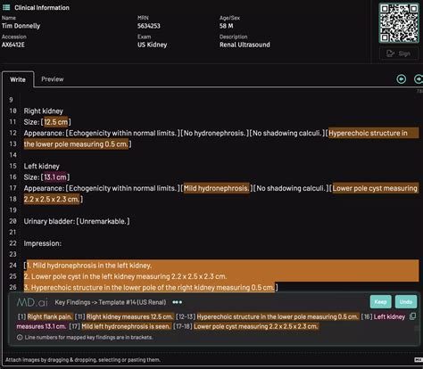 Md Ai Ai Powered Reporting And Annotation For Radiology