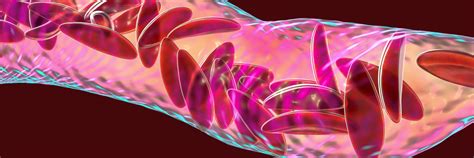 Exploring The Potential Of Base Editing For Sickle Cell Disease Revvity