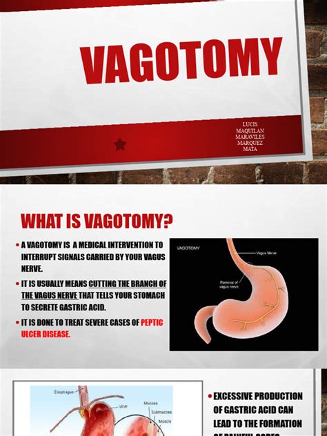 Vagotomy Pdf Stomach Gastrointestinal Tract