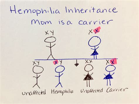 Illustrations Of Hemophilia Inheritance Patterns Need Updating
