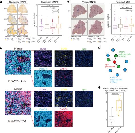 Single Cell And Spatial Transcriptome Analyses Reveal Tertiary Lymphoid Structures Linked To