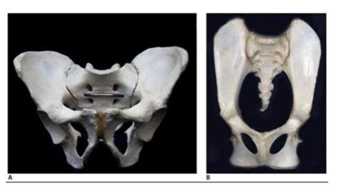 Quadruped Tfl Evolution To Bipedalism Osteomag