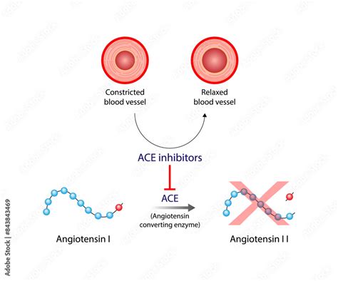 Angiotensin Converting Enzyme Inhibitors Ace Inhibitors Renin