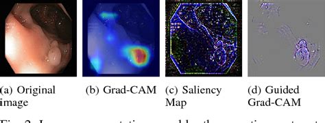 Figure 1 From Dissecting Deep Neural Networks For Better Medical Image Classification And