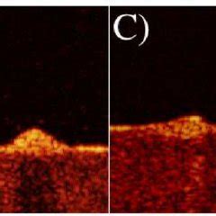 A Single Slice Of An OCT Scan For Different Scan Media The Dark Region Download Scientific
